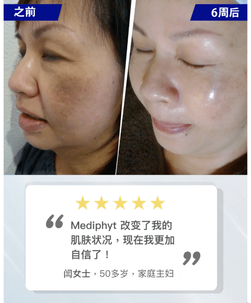 BA_Yan_CH 1 - Mediphyt